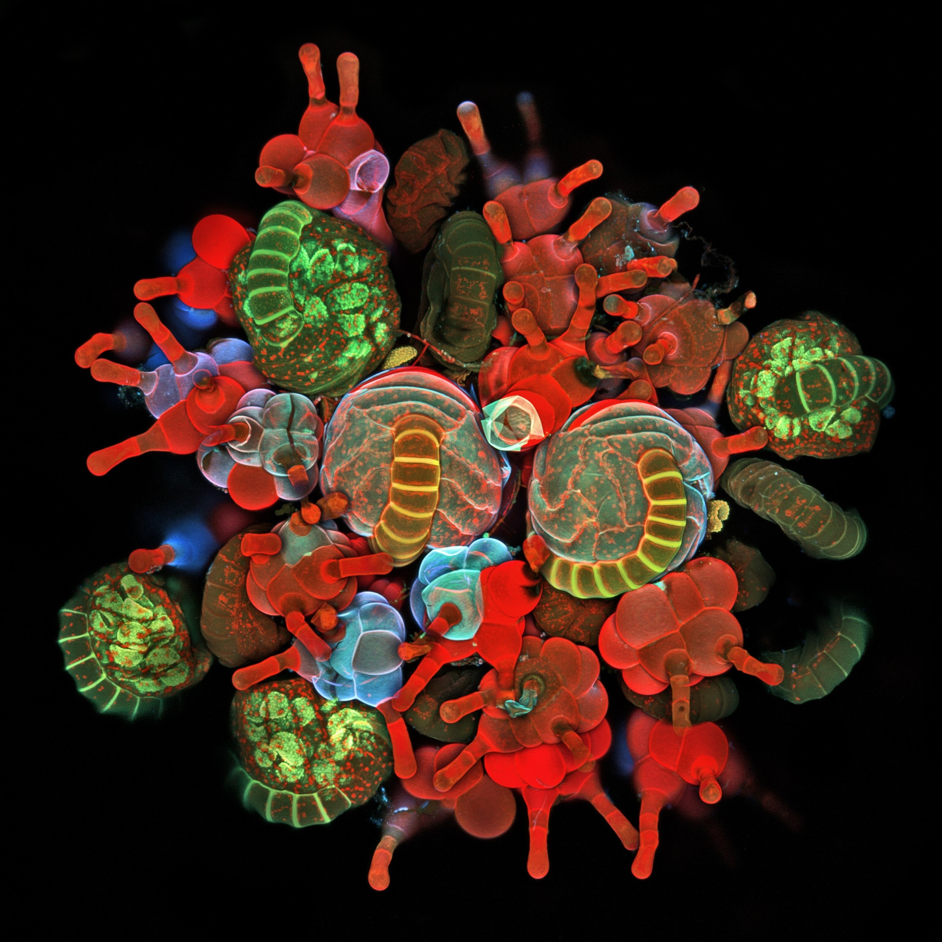 Pictures: Capturing the Beauty of Life Through a Microscope