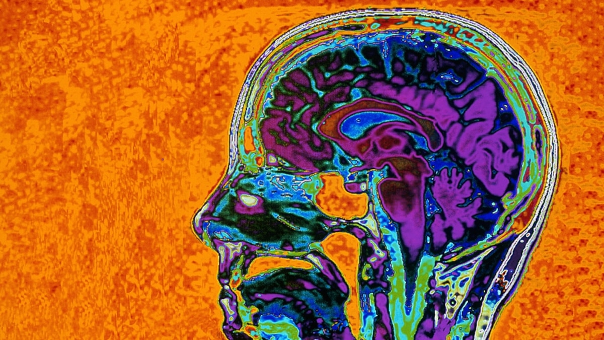 People Can Hallucinate Color at Will | National Geographic