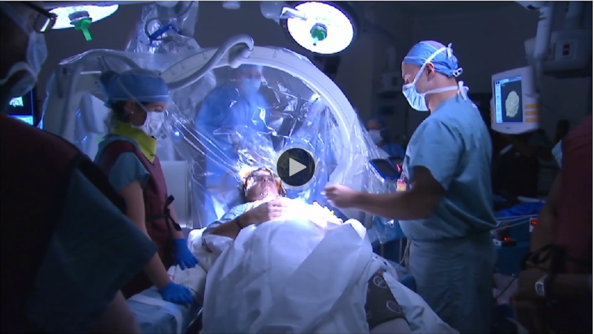 First Brain Surgery Aired Live on American TV Goes Smoothly | National ...