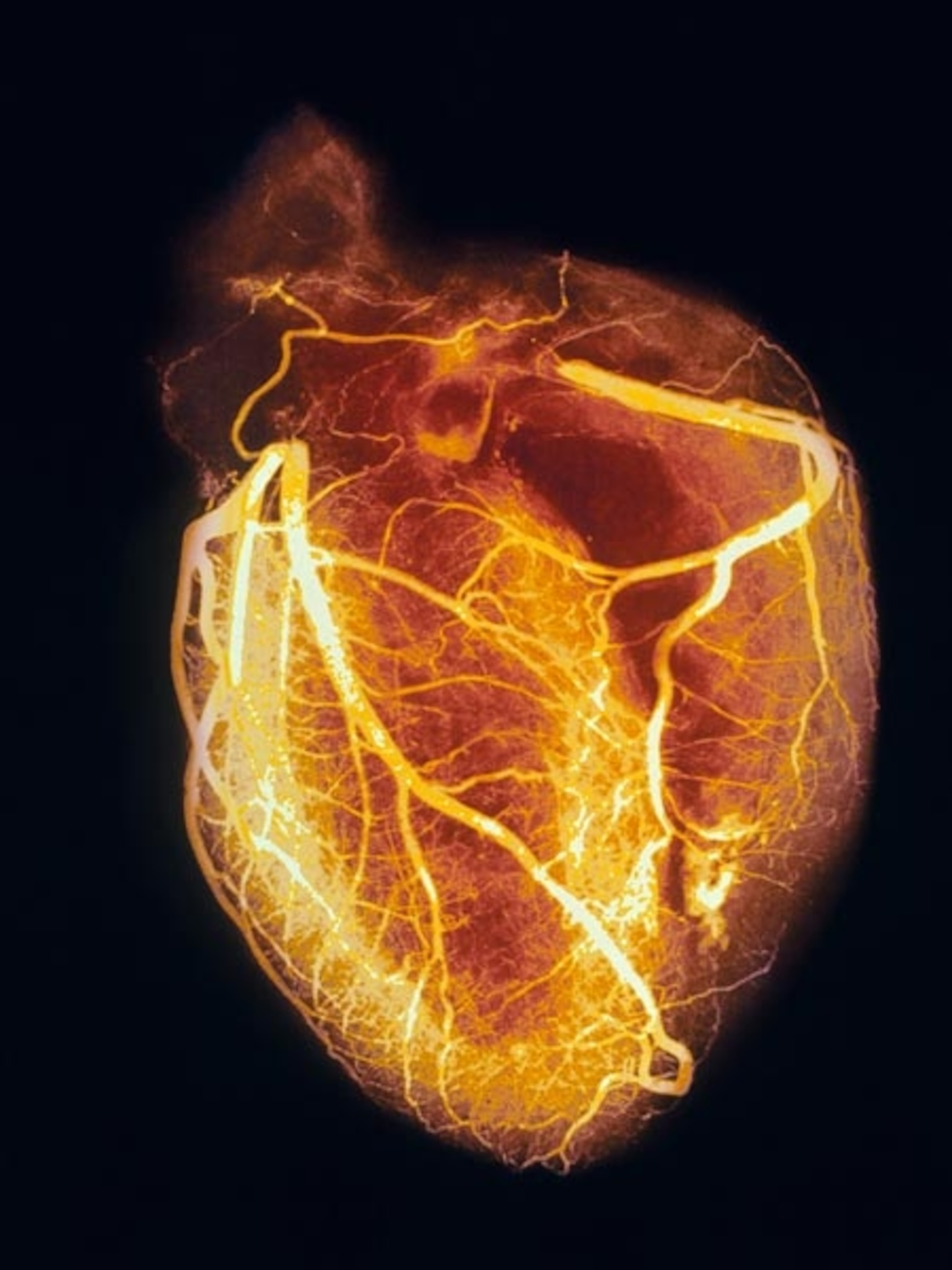 Heart Information, Facts, Photos | National Geographic