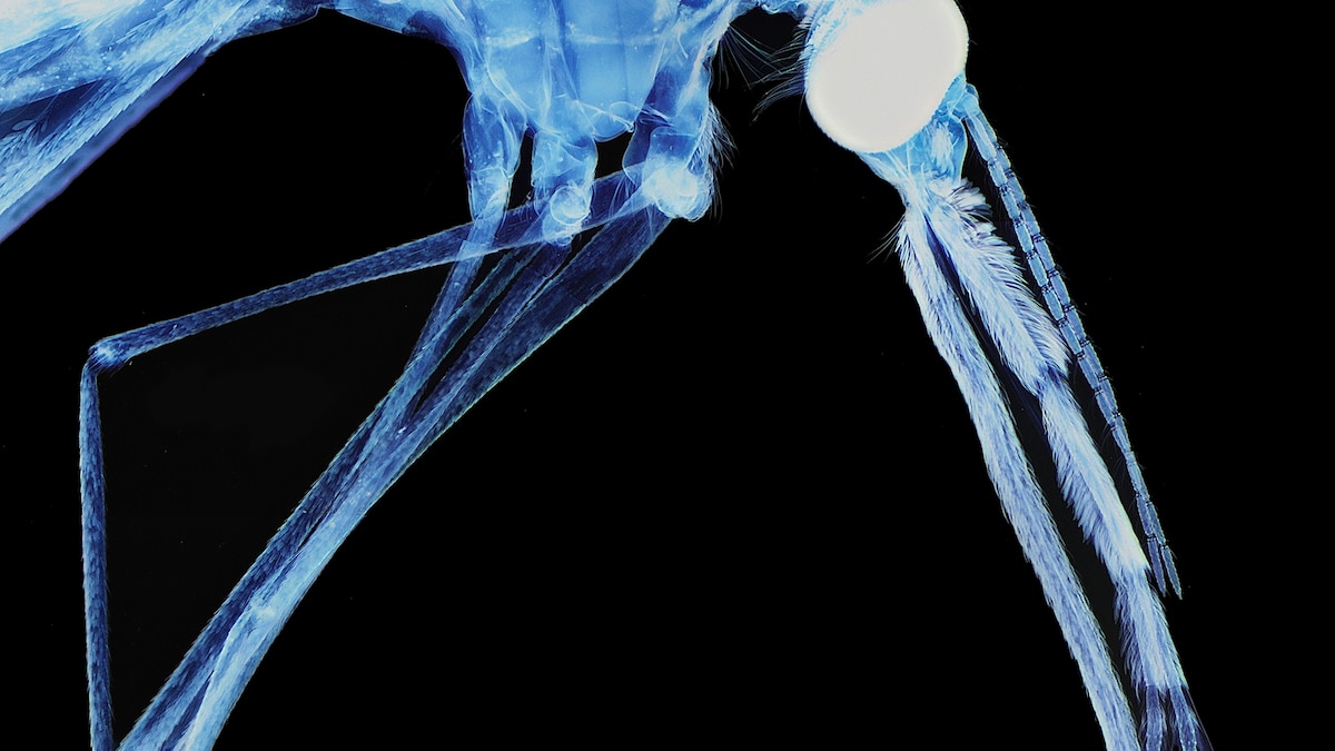 Is malaria making a comeback in the U.S.?