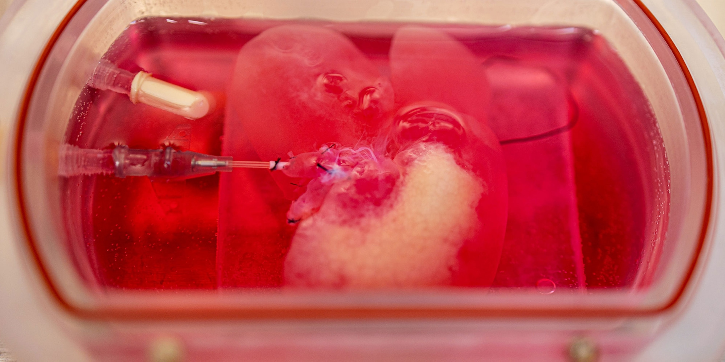 Tiny liver grown in the lab. Here's what it can teach us.