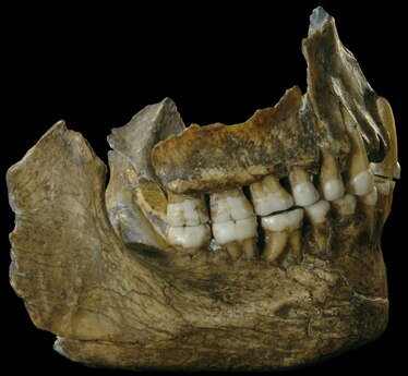 Prehistoric 'Aspirin' Found in Sick Neanderthal's Teeth