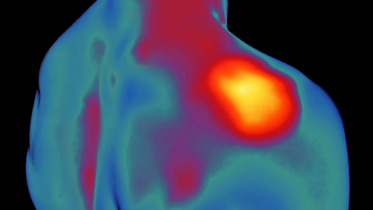 Trigger point locations, symptoms, and treatments | National Geographic