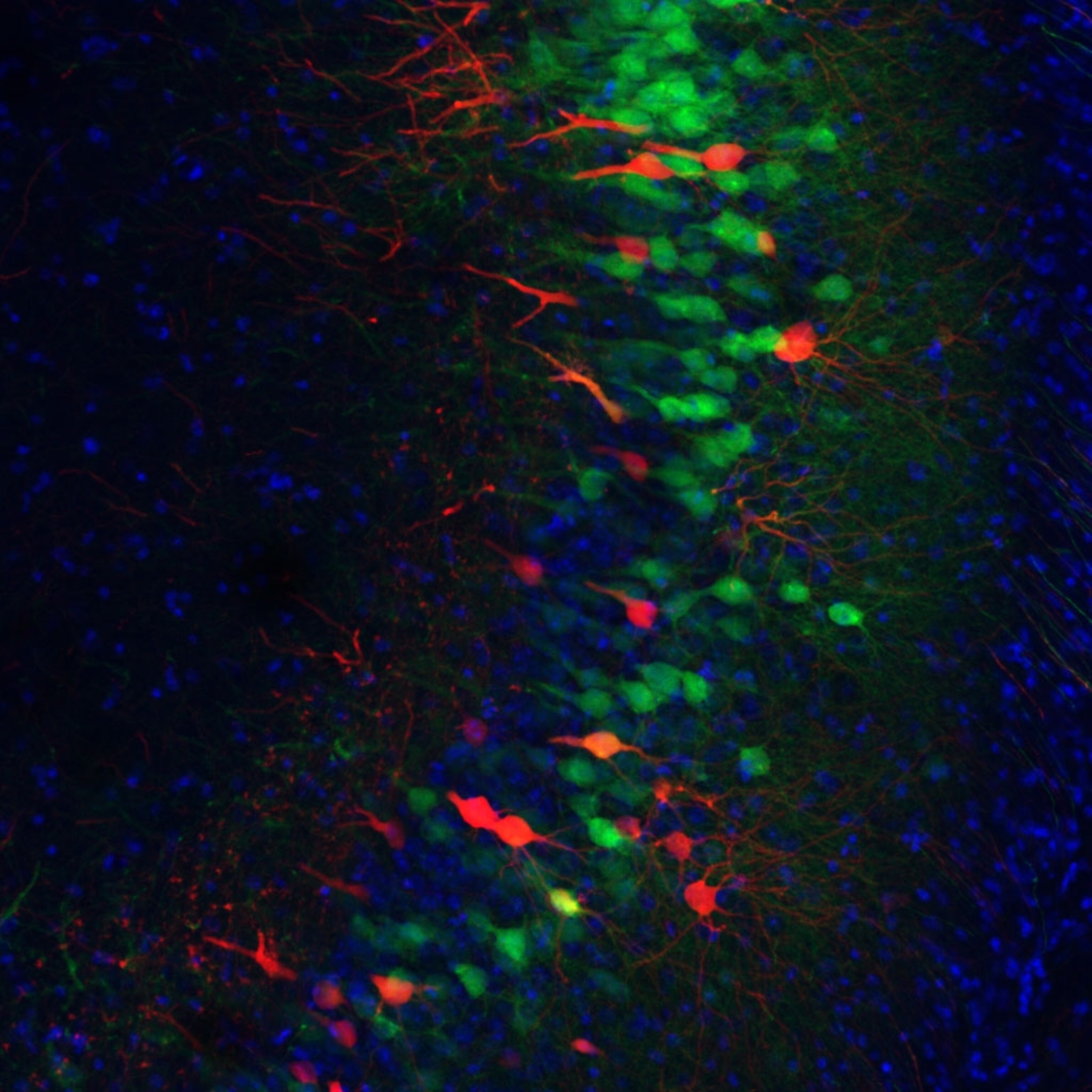 Memories Can Be Altered in Mice. Are Humans Next?