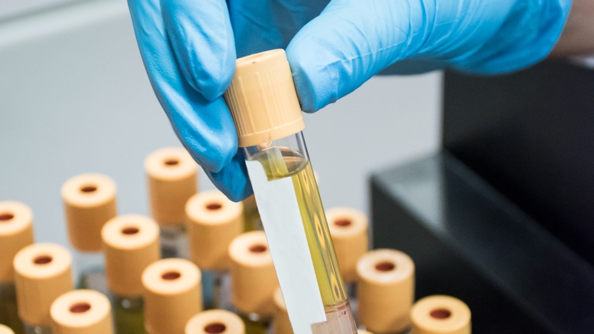 This lesser-known cholesterol can quadruple your heart-attack risk ...