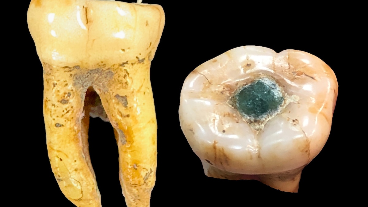 The ancient Maya may have had sophisticated dentists | National Geographic
