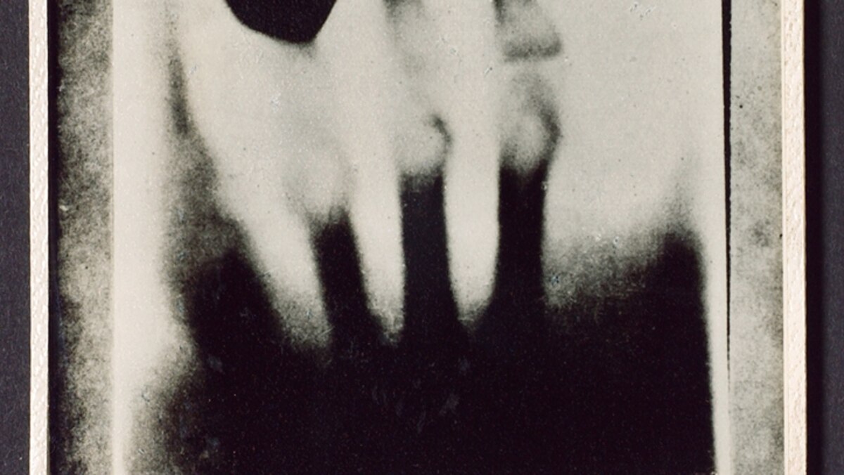 Photos: X-Ray History—Hidden Kittens, Quackery, and More | National ...