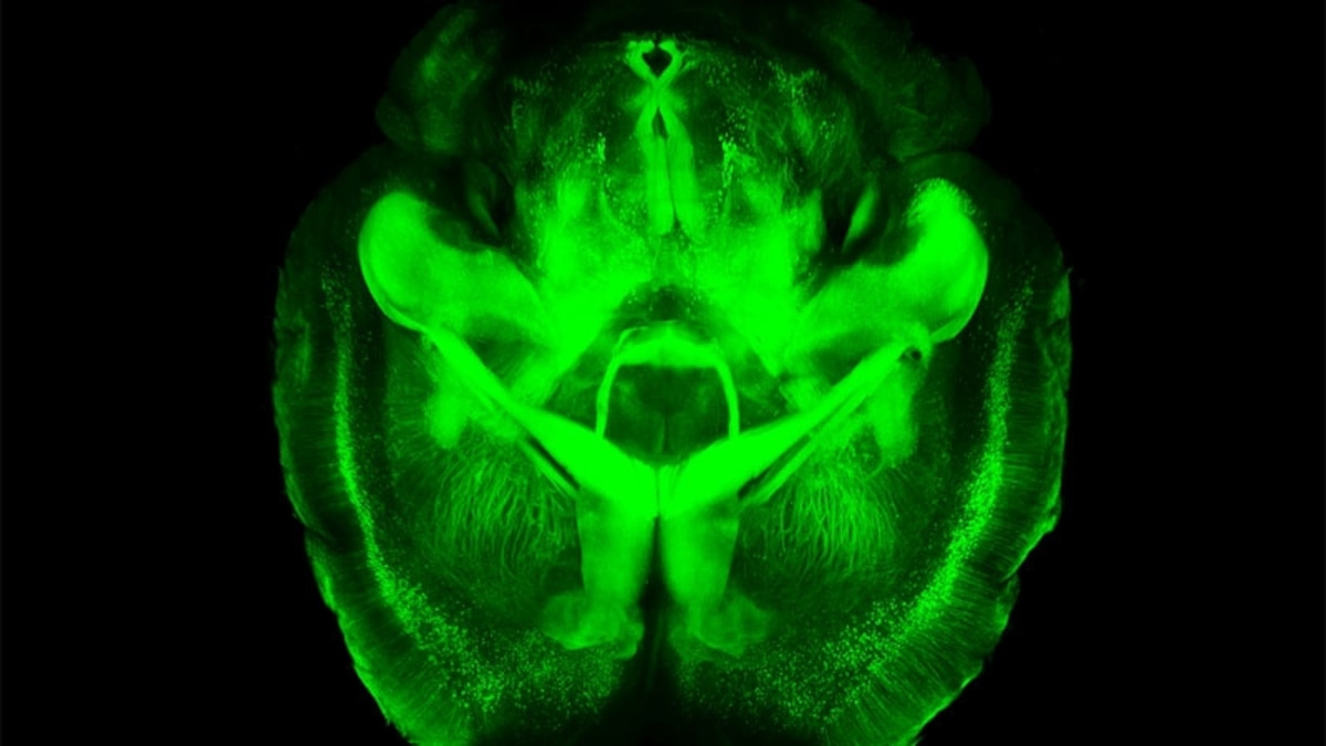 Getting Better Views of Brains by Turning Them Invisible | National ...
