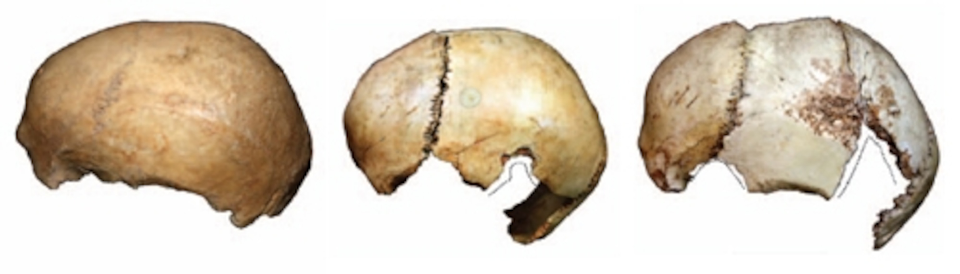 Prehistoric Brits made the world’s earliest skull-cups | National ...