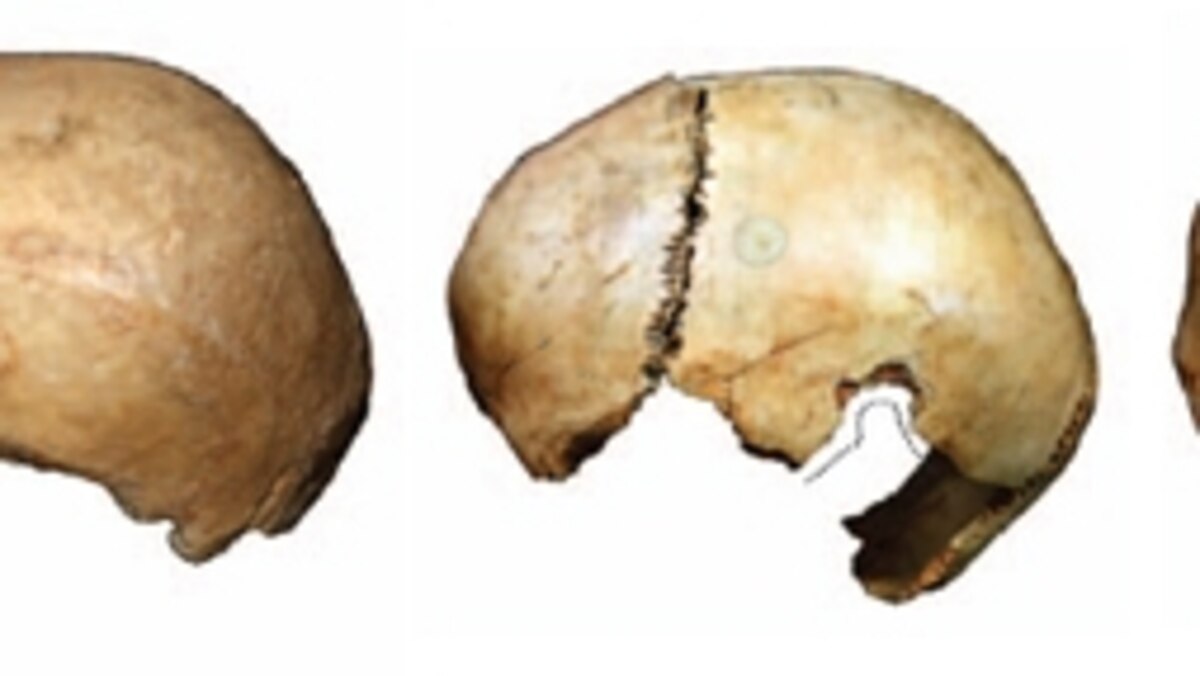 Prehistoric Brits made the world’s earliest skull-cups | National ...