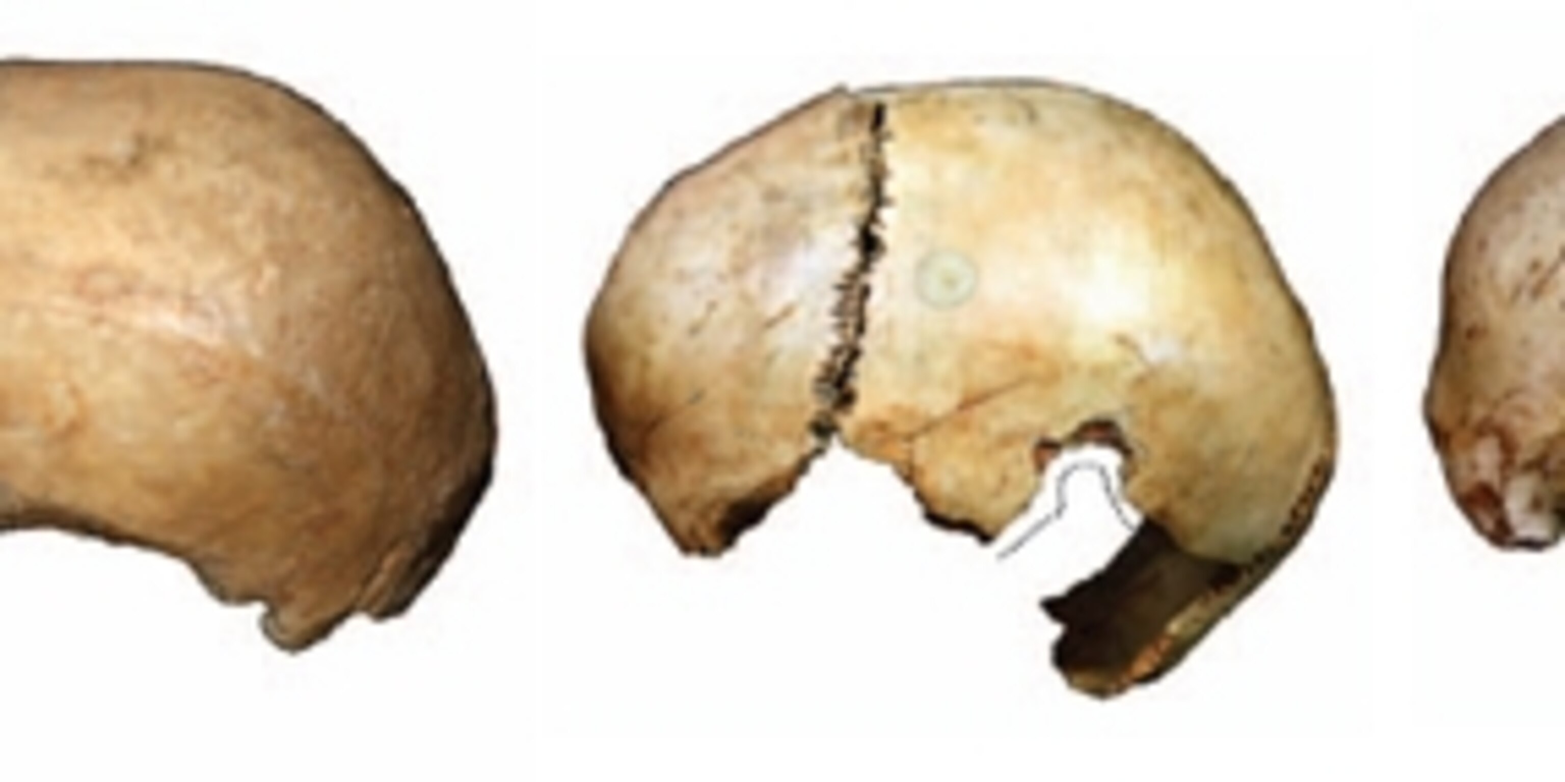 Prehistoric Brits made the world’s earliest skull-cups