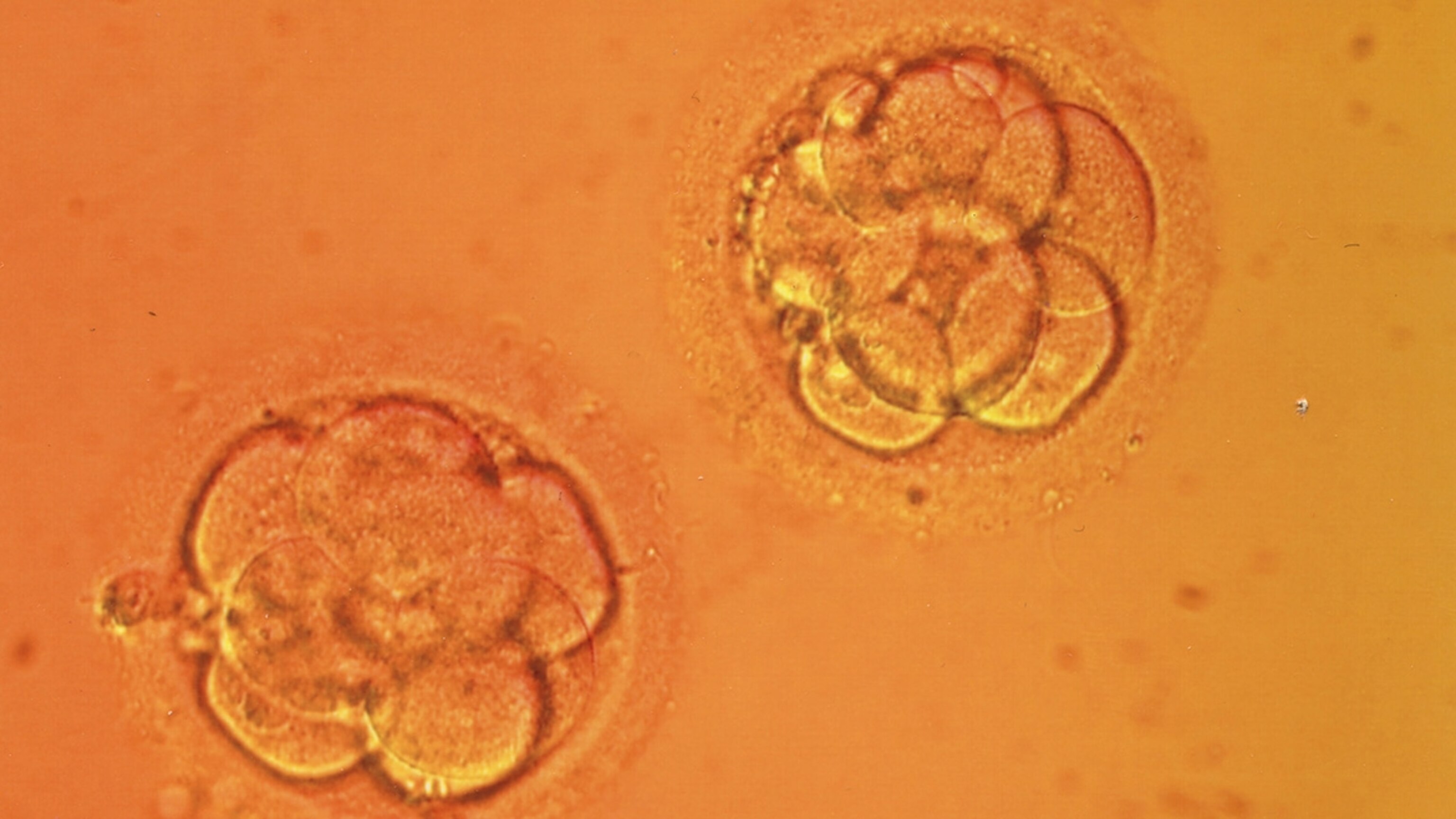 Editing Human Embryos: So This Happened