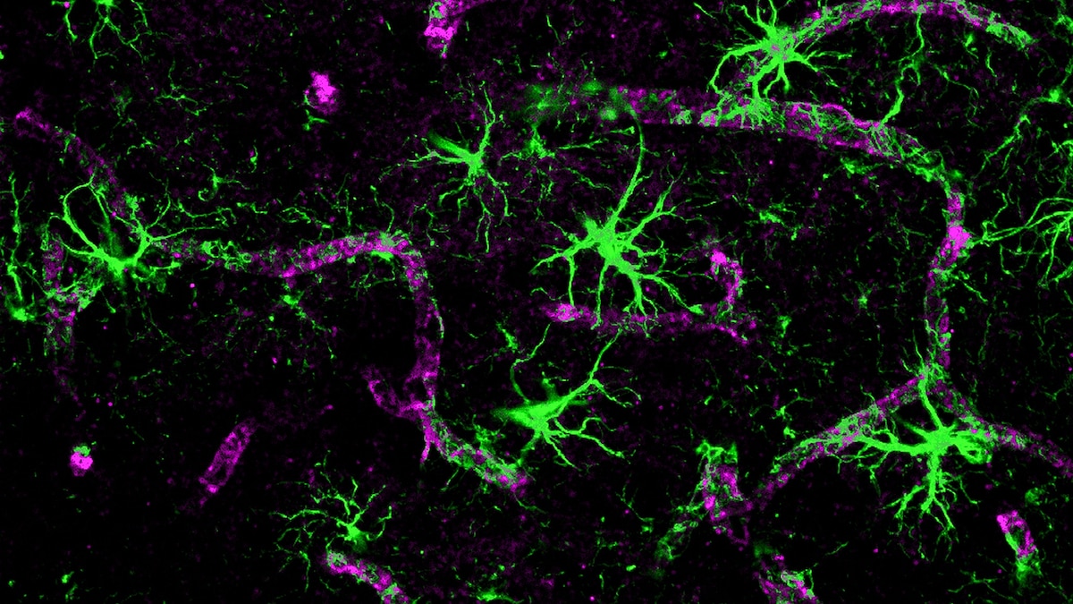 How Your Brain Cleans Itself—Mystery Solved? | National Geographic