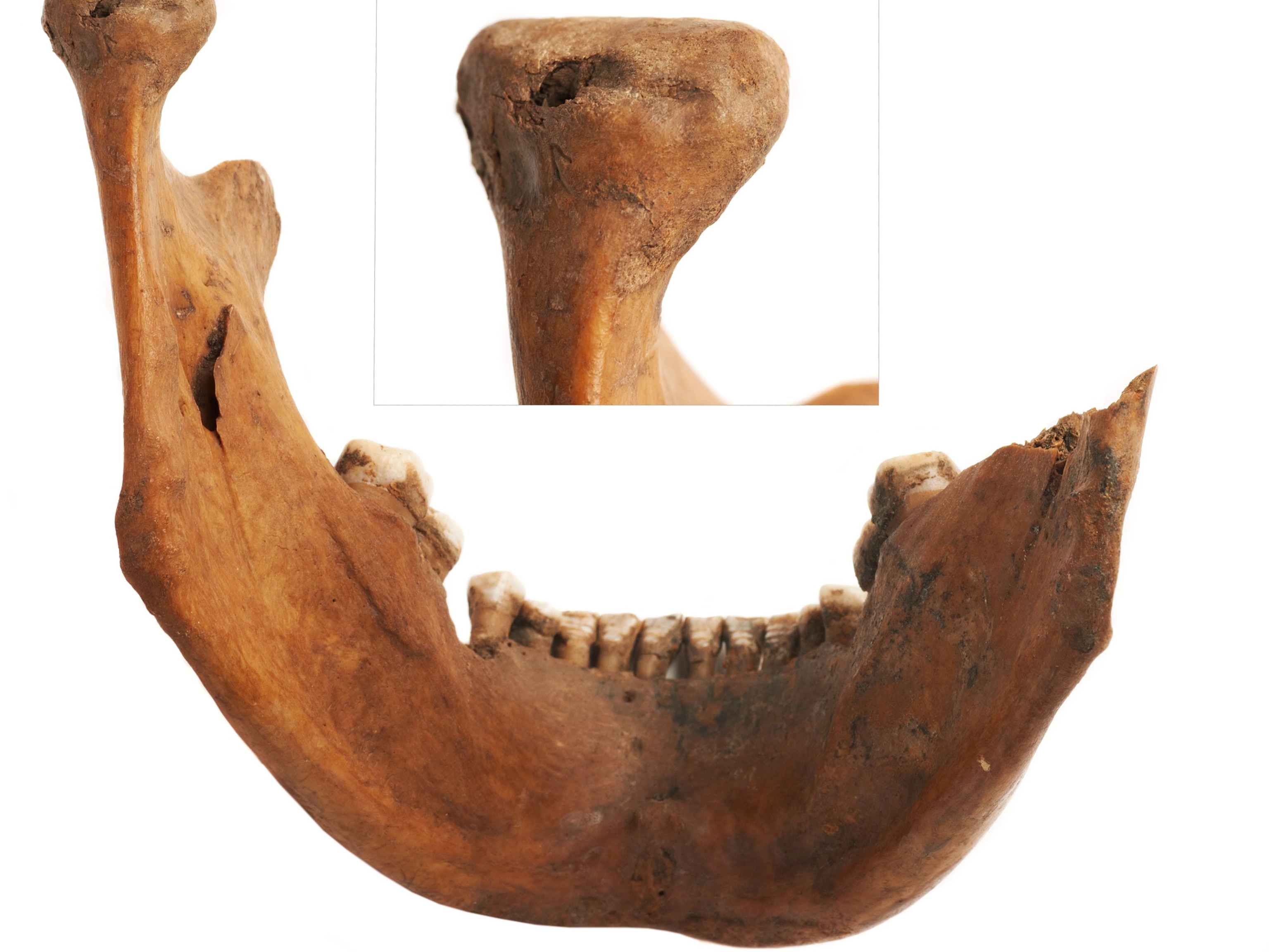 Headhunters' Trophy Skulls Uncovered From Ancient London