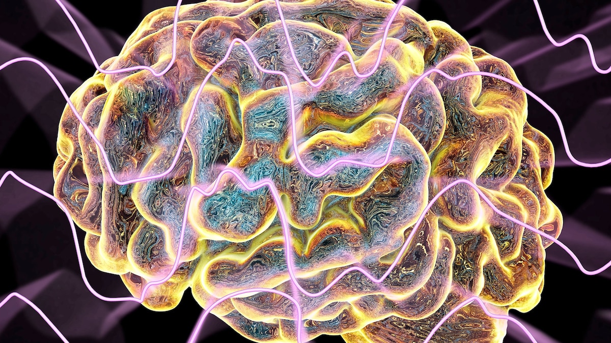 'Exploding head syndrome'? Inside a mysterious, disturbing sleep ...