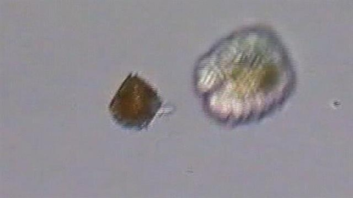 ‘Gatling Gun’ Plankton Reveals Violent Microbial World | National ...