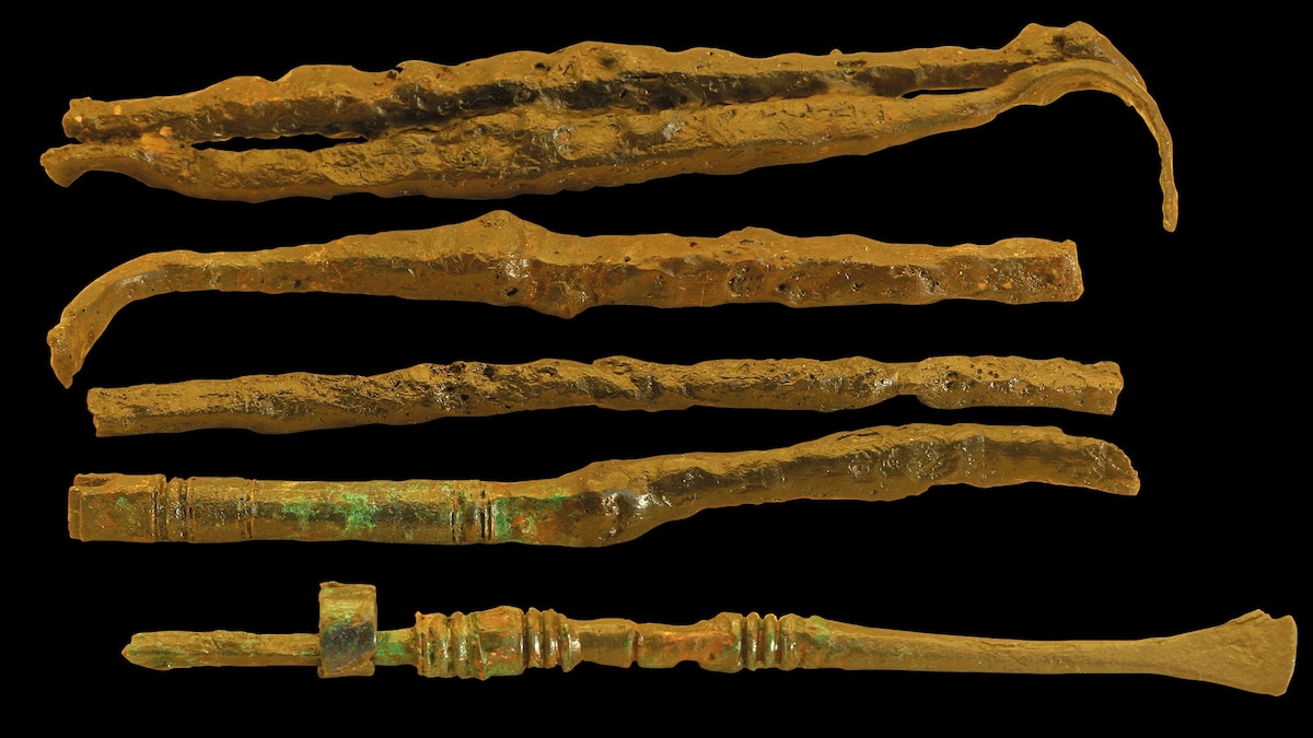 This is what a surgical clinic looked like in ancient Rome | National ...