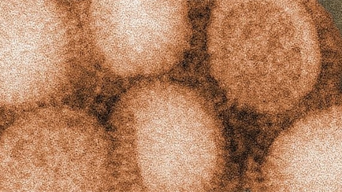 How drug-resistant flu took us by surprise