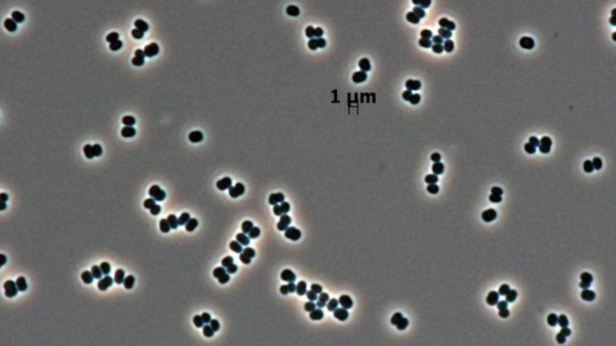NASA discovered a bacteria that can ‘play dead’—and might have ...