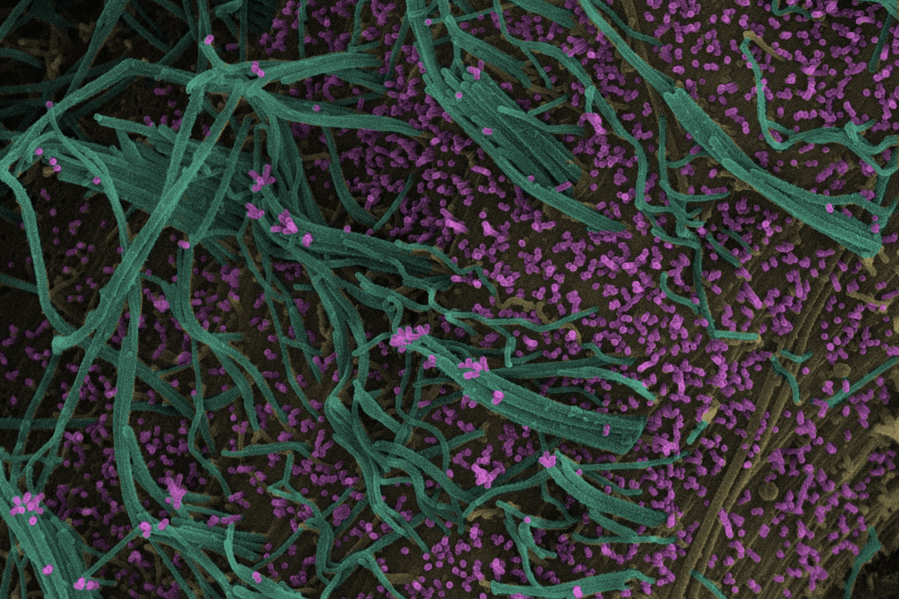 What happens if the flu and RSV fuse into a single virus? Now we know.