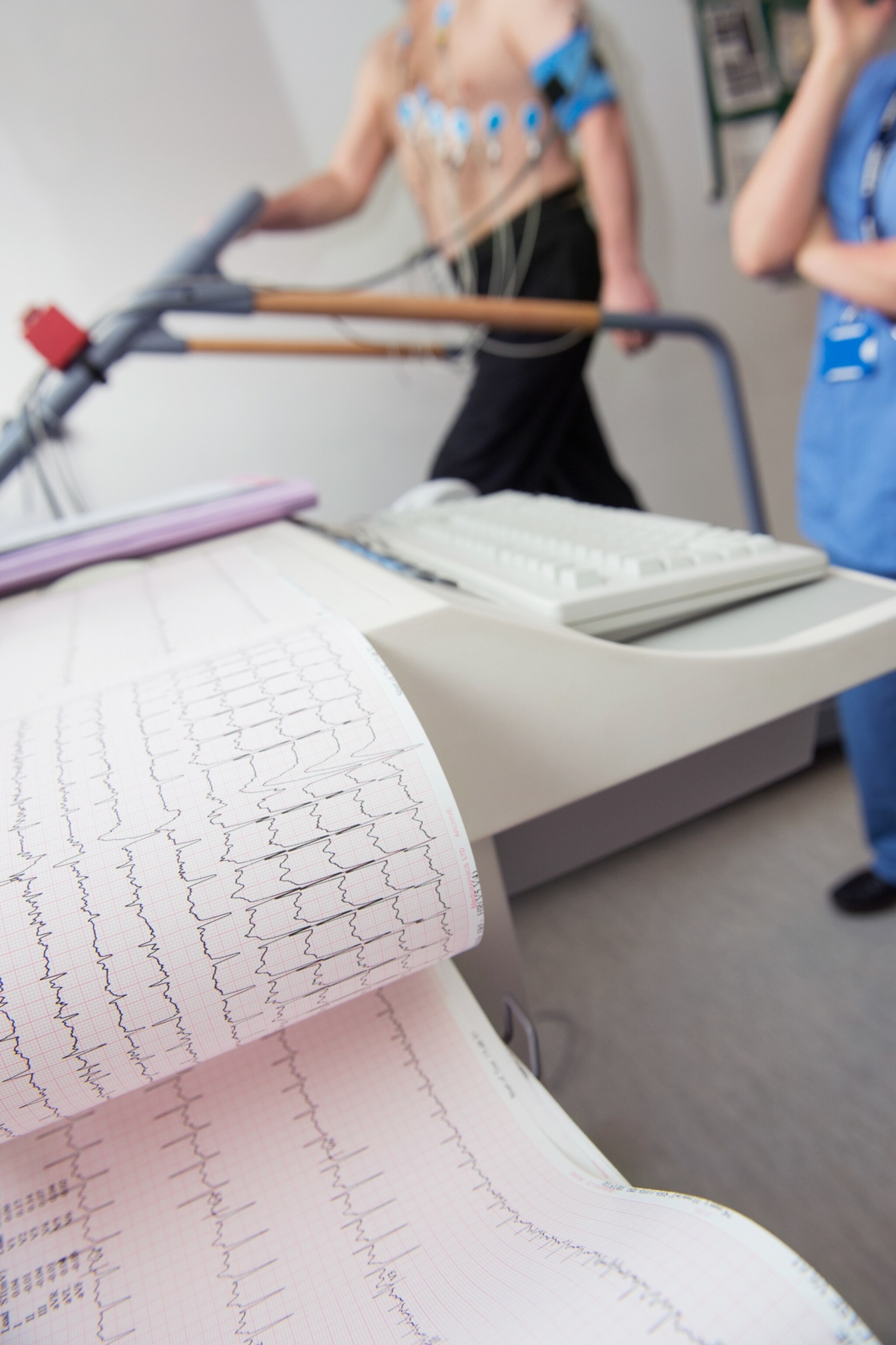 What a cardiac stress test can reveal about your risk of cancer