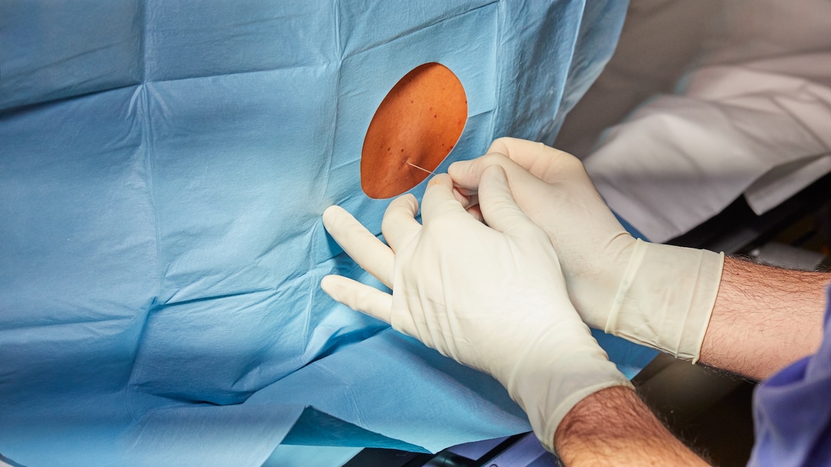 Epidurals may do more than relieve pain—they could save lives ...