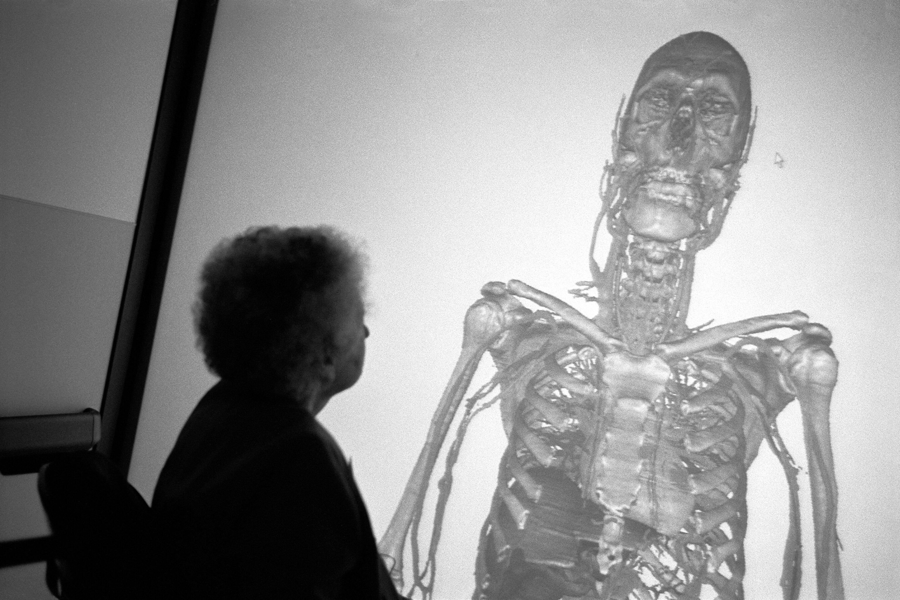 Susan Potter gave her body to science. Her cadaver became immortal.