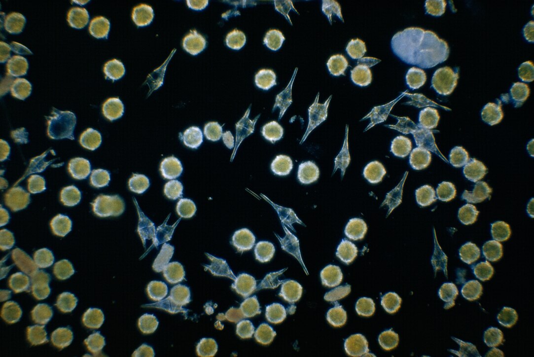 Dinoflagellates Under Electron Microscope