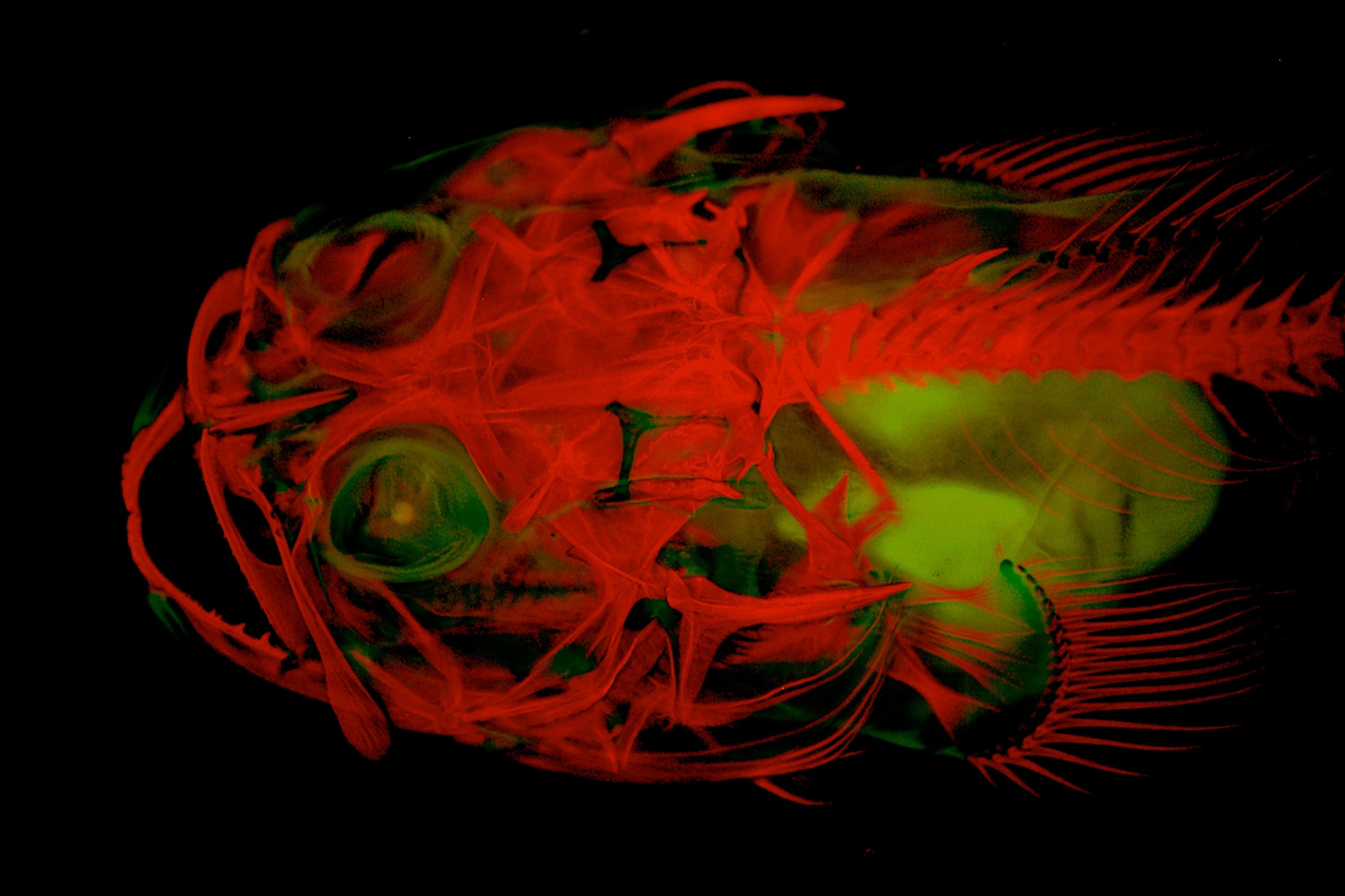 Skeleton photos are getting a boost with the help of gelatin