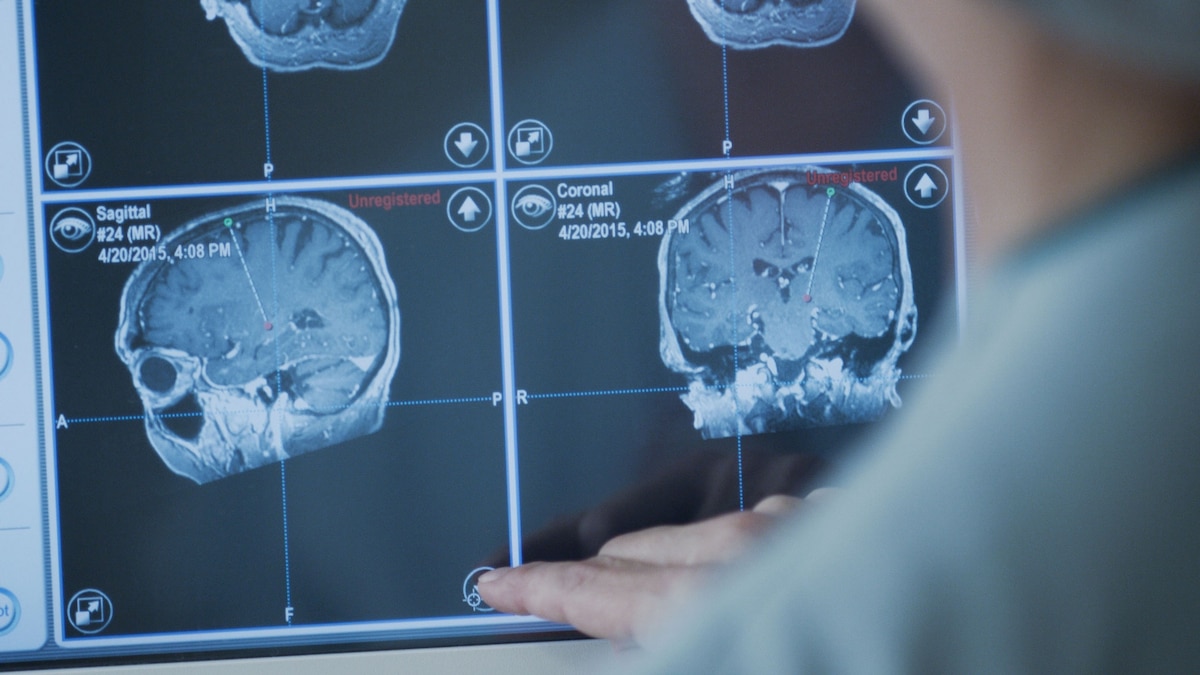 Why This Doctor Is Performing Brain Surgery on Live TV | National ...