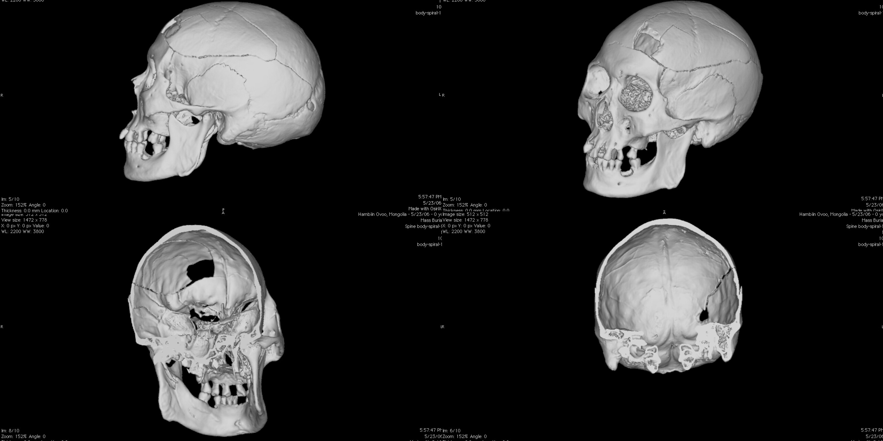 Life After Death: Bruno Frohlich | Innovators