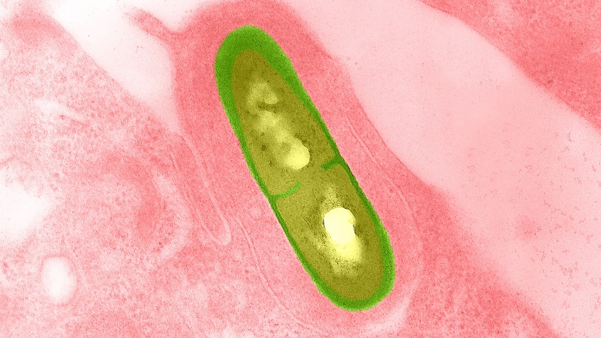 Got food poisoning? One of these 4 bugs is likely the cause | National ...