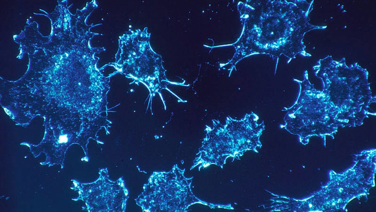 A Floating Autobiography of a Cancer | National Geographic