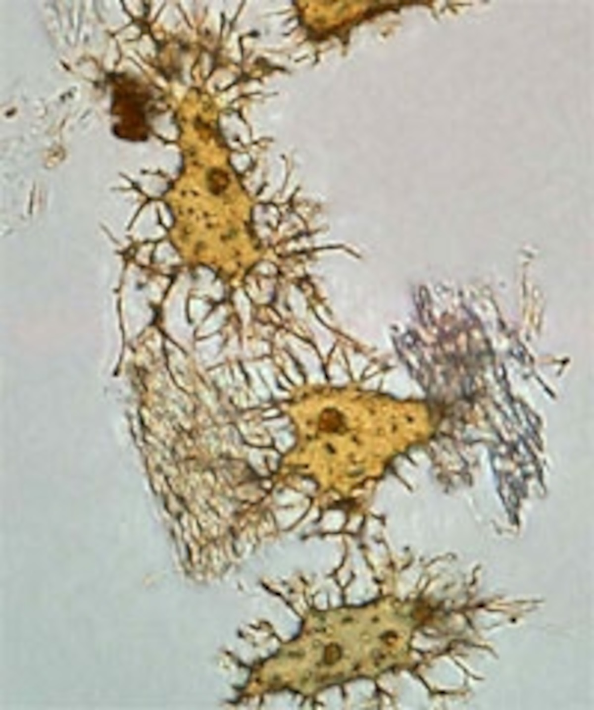 Dinosaur proteins, cells and blood vessels recovered from Bracyhlophosaurus