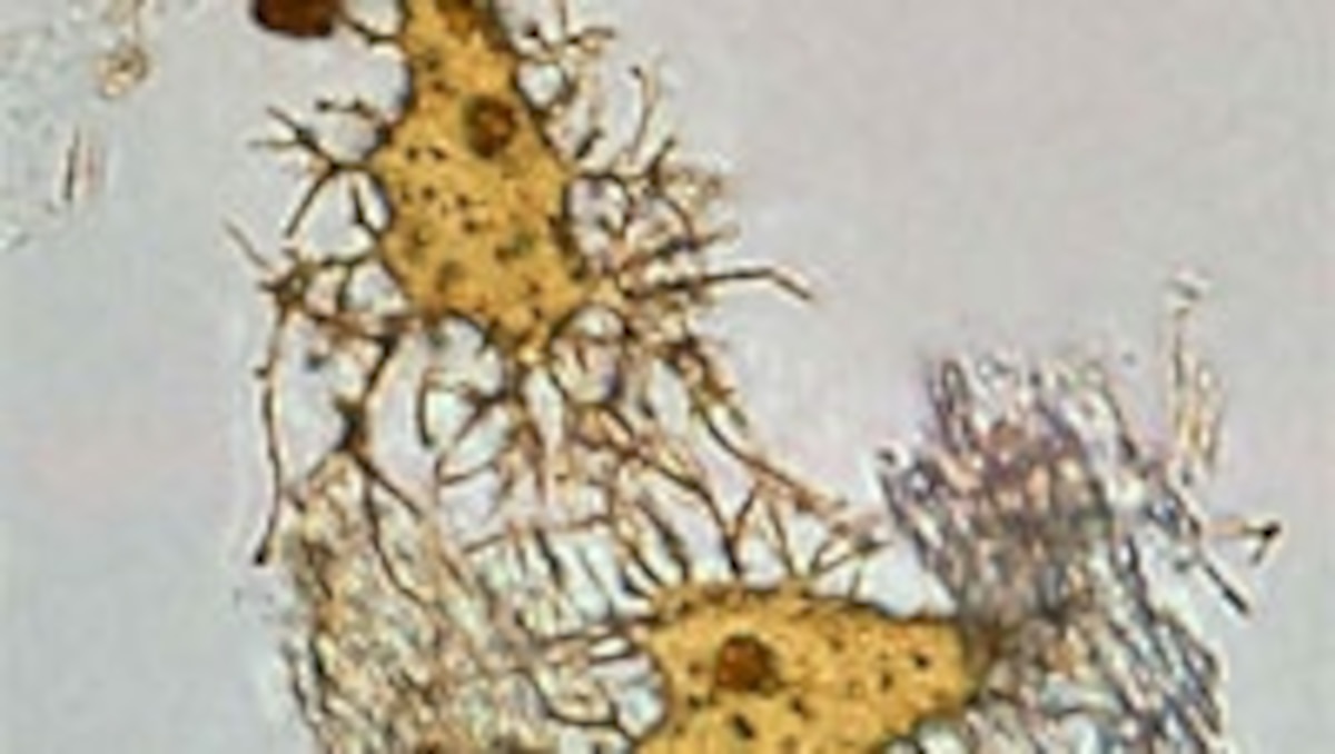 Dinosaur proteins, cells and blood vessels recovered from ...