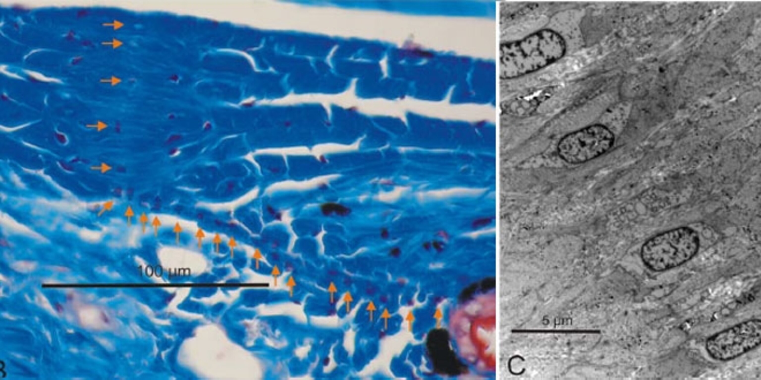 What Do Lizard Tails Have In Common With Toilet Paper?