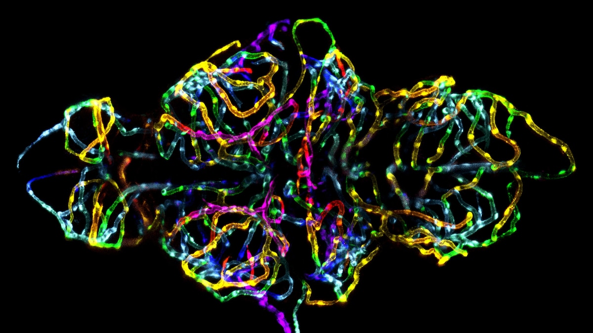 Pictures: Best Micro-Photos of 2012 | National Geographic