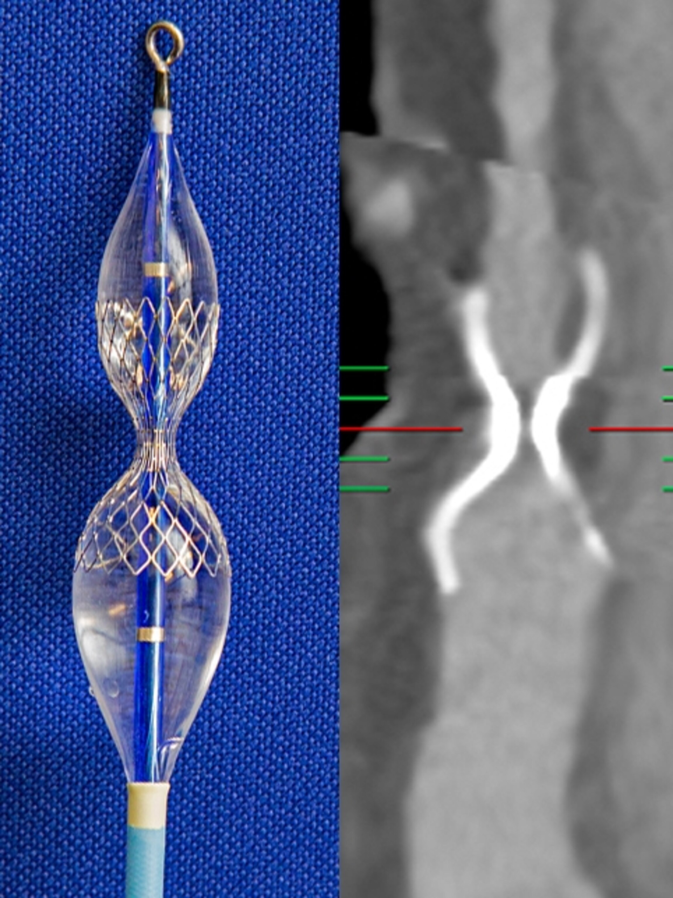 Scientists are unraveling the mysteries of pain