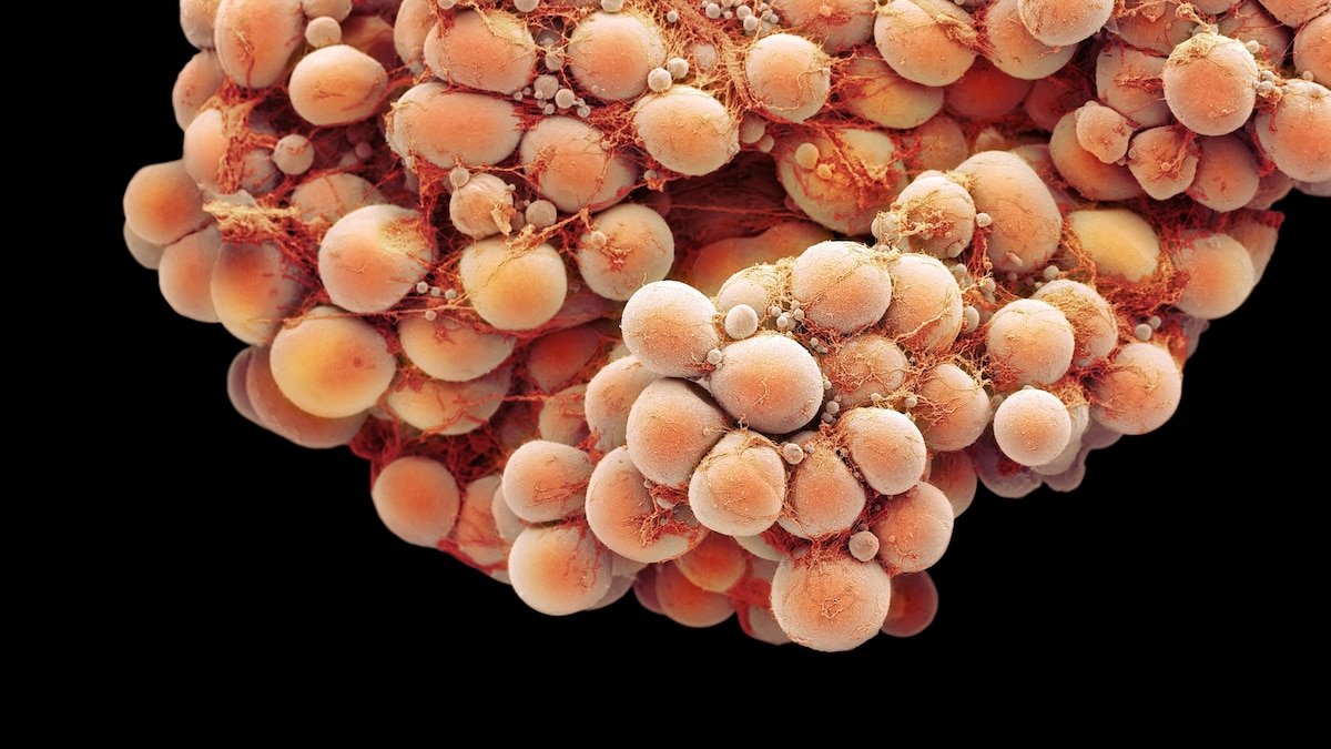 This little-known type of fat may actually protect your heart ...