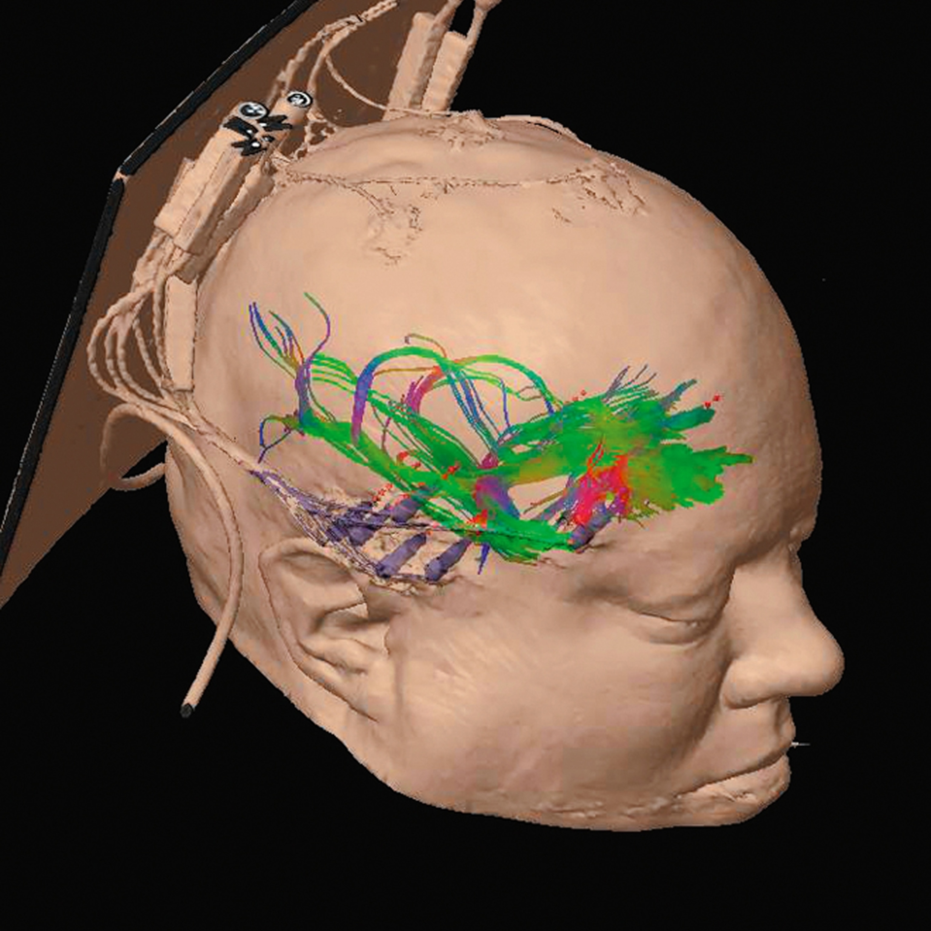 Secrets of the Brain