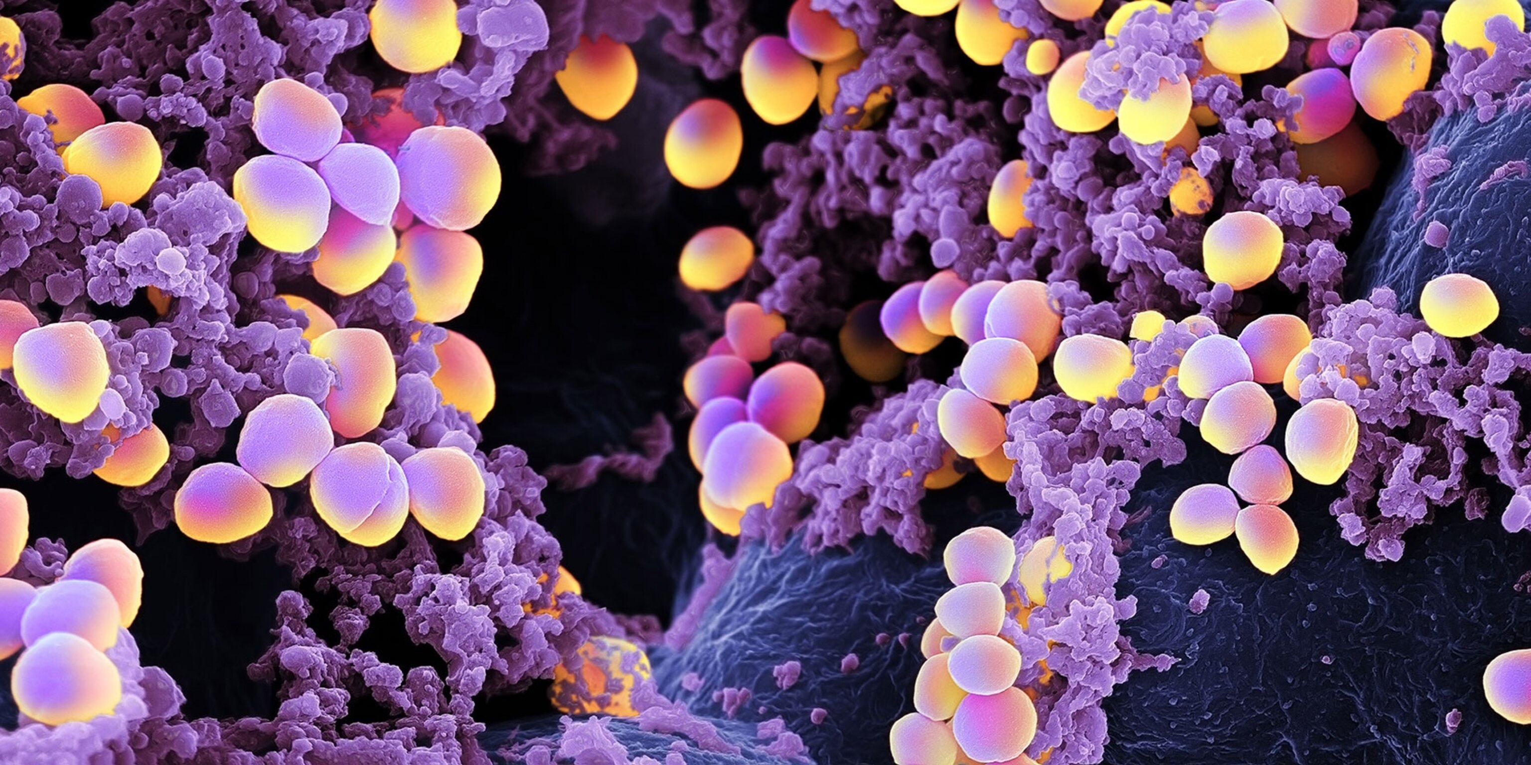 Antibiotic Found in Noses—Here’s What You Need to Know