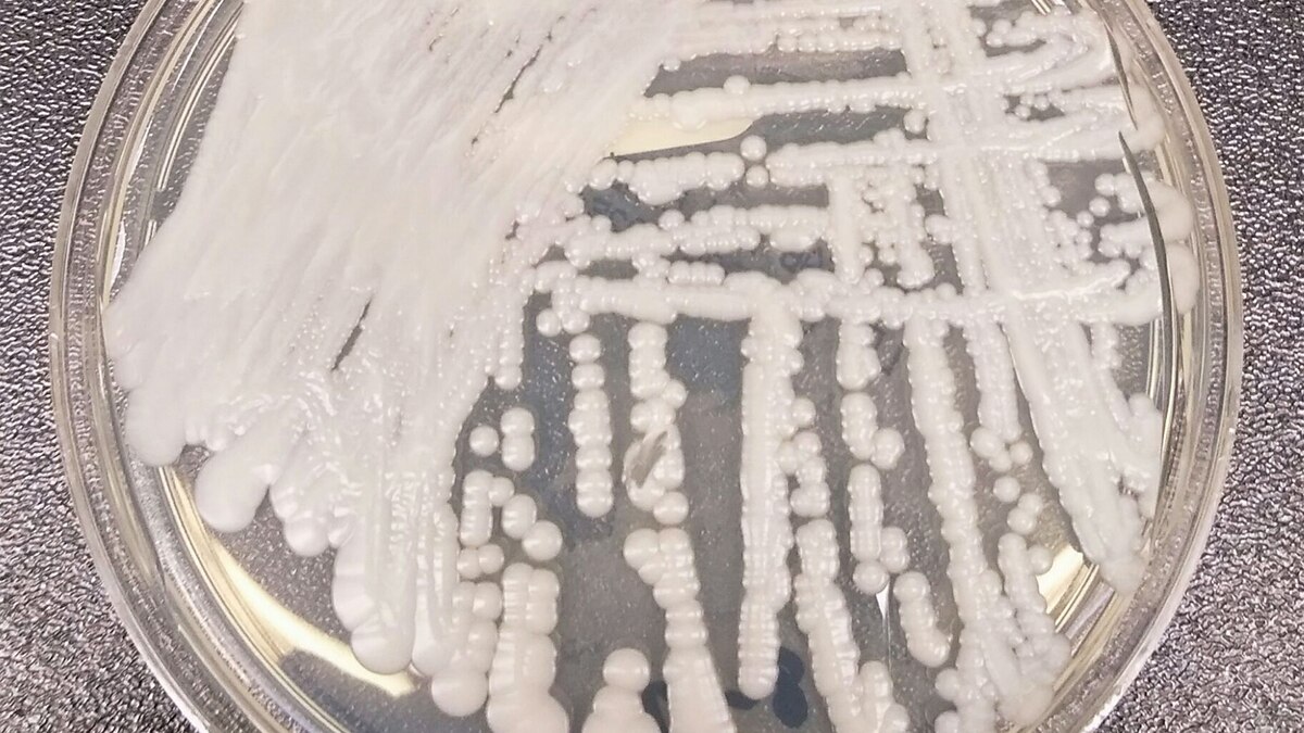 Fatal Fungus Linked to 4 New Deaths—What You Need to Know | National ...