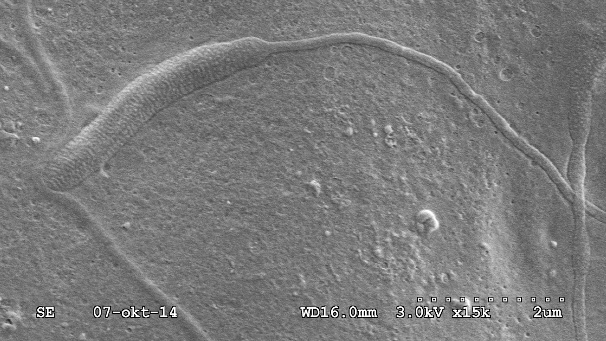 50-Million-Year-Old Worm Sperm Found in Antarctica | National Geographic