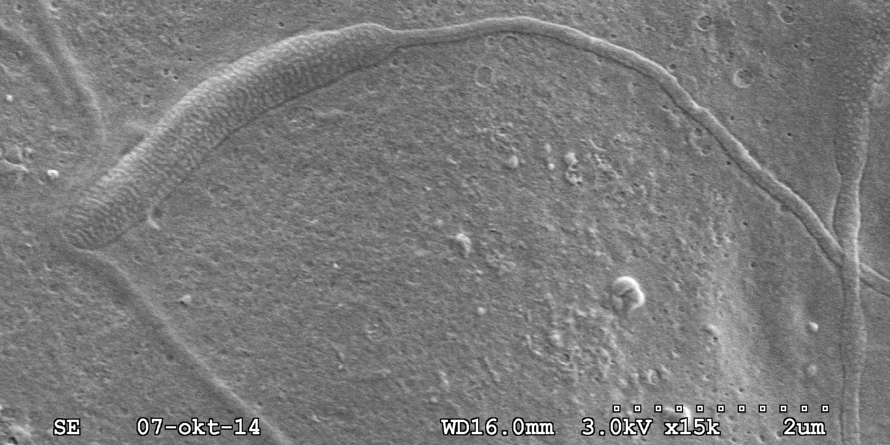 Sperm Cell Under Electron Microscope 