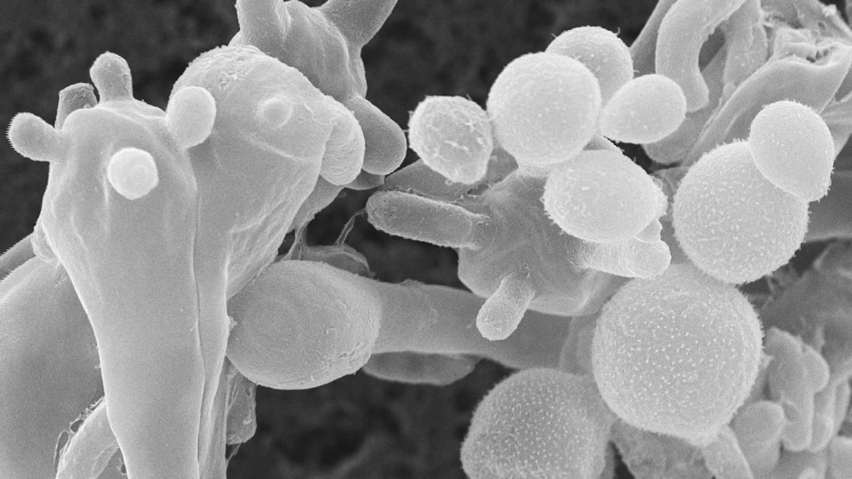 New, Deadly Cryptococcus Gattii Fungus Found in U.S. | National Geographic