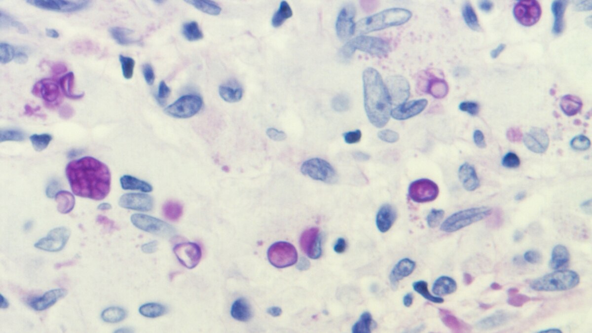 Toxic New Algae Species Discovered | National Geographic