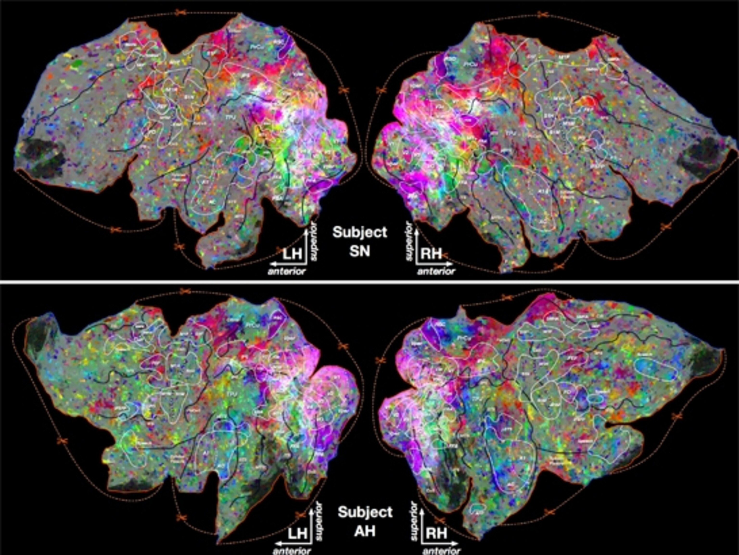 The Where of What: How Brains Represent Thousands of Objects