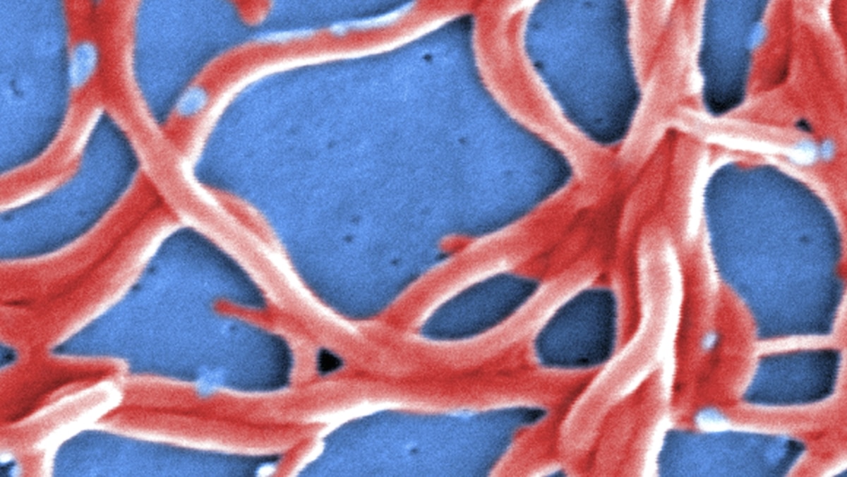 Tickborne Diseases Widespread Serious And Taking Us By Surprise