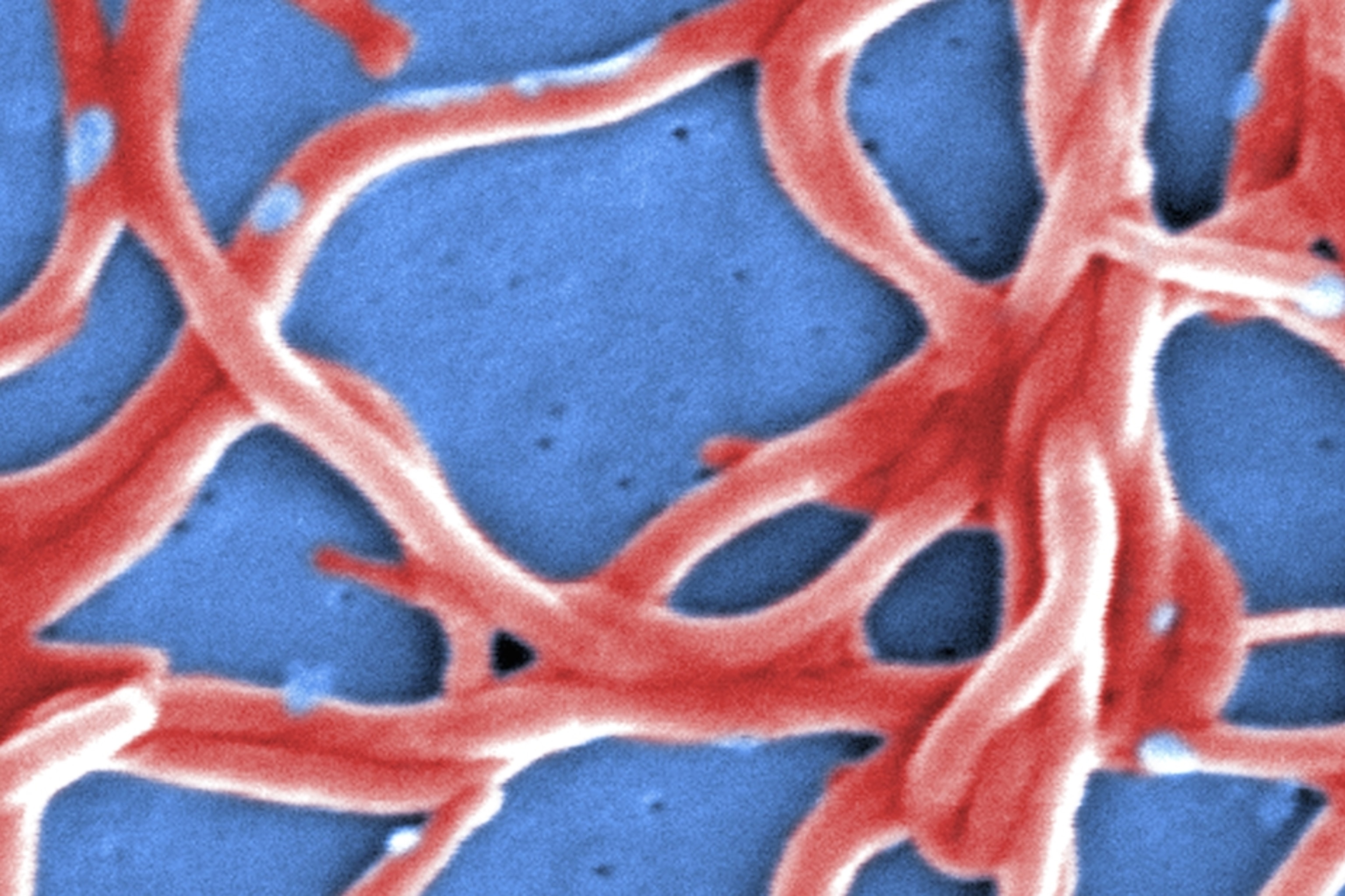 Tickborne Diseases: Widespread, Serious, and Taking Us By Surprise